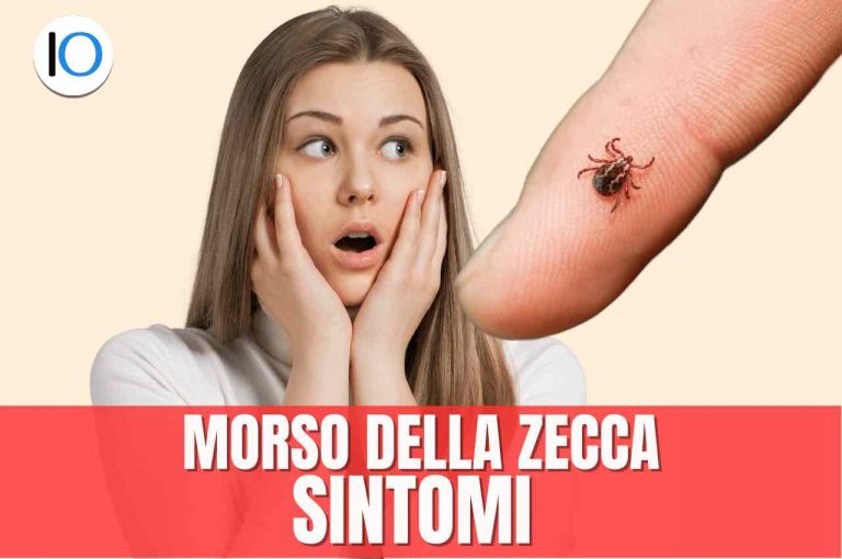 I sintomi del morso della zecca da non sottovalutare, bisogna fare ...